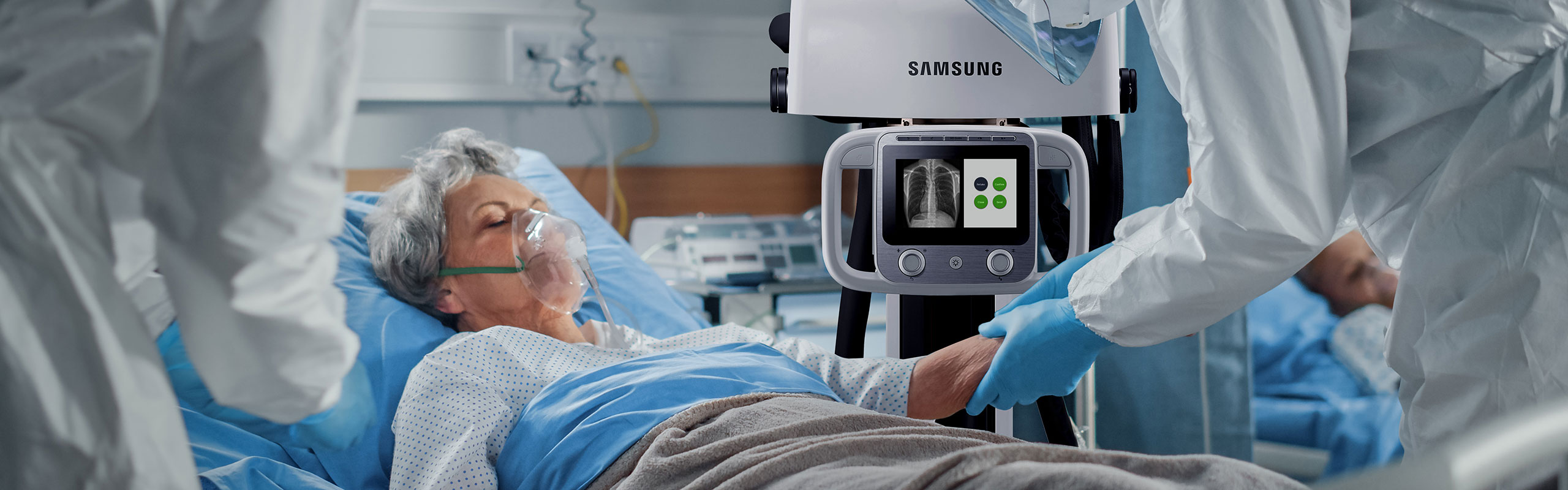 Usefulness of On-Device CAD in clinical practice - ESR Connect